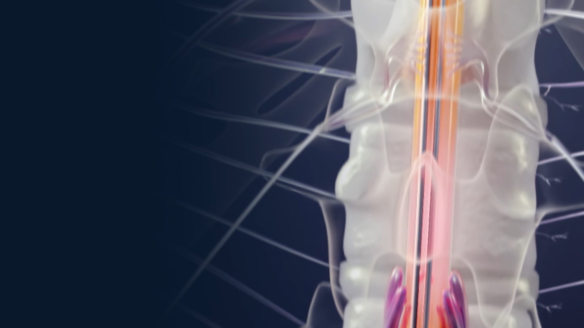 Homepage - Saluda Medical US